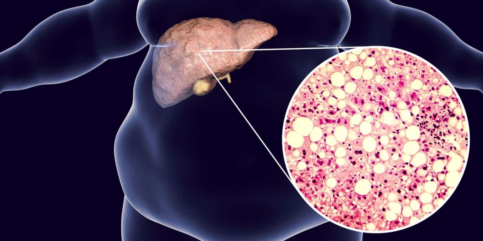 How to Cleanse and Restore Your Liver Health