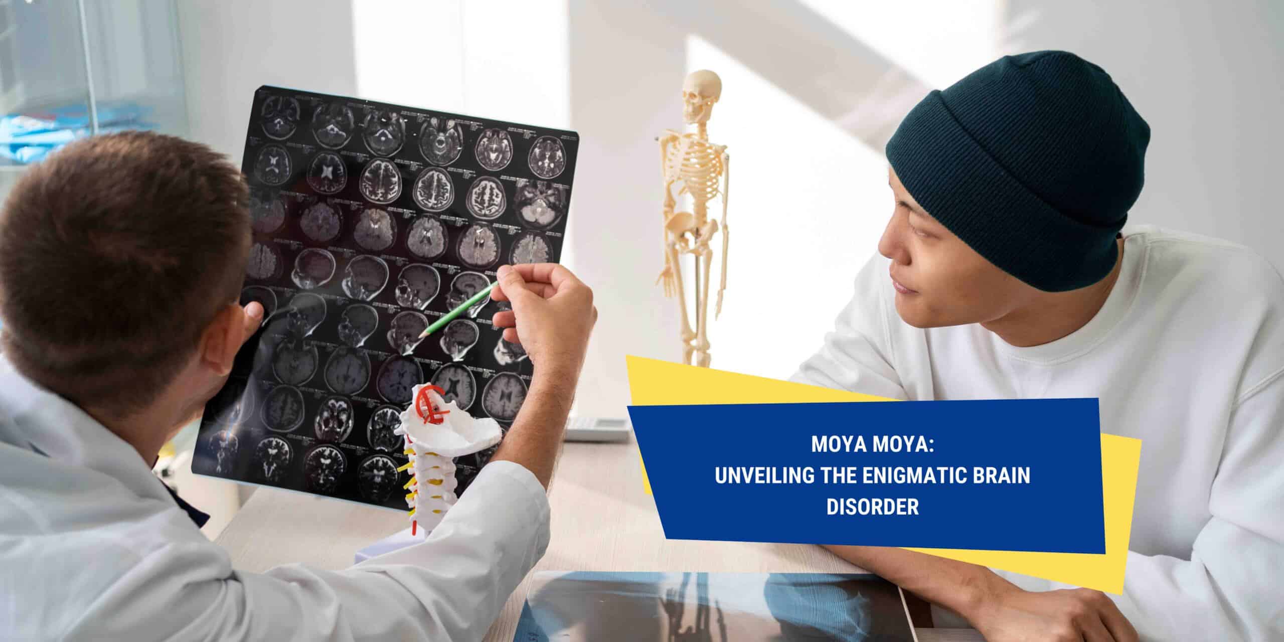 Moya Moya: Unveiling the Enigmatic Brain Disorder | OneHealth.sg ... Moya Moya: Unveiling the Enigmatic Brain Disorder | OneHealth.sg ...