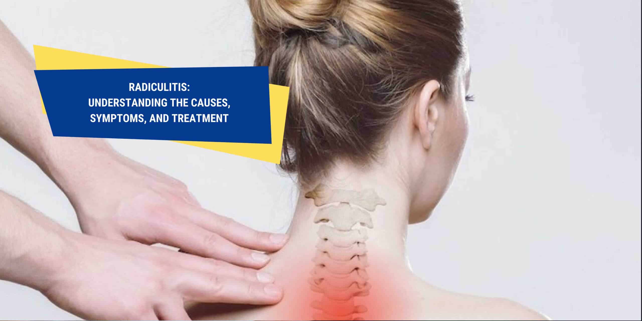 Thoracic Radicular Paincausessymptomstreatment